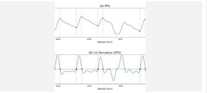 30 Best Crypto Indicators For Day Trading